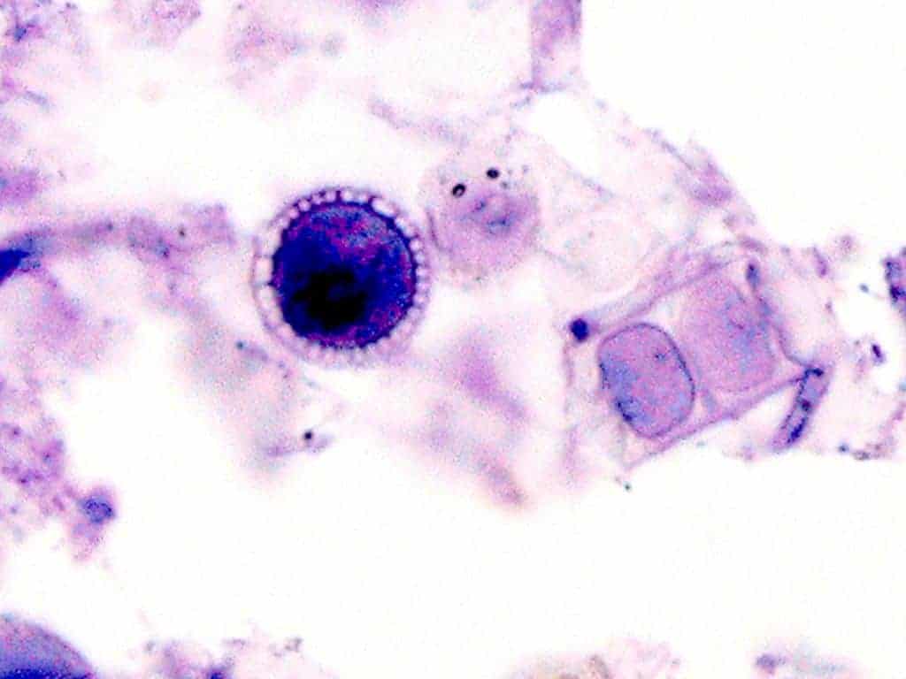 Diatoms